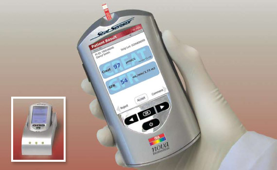 StatSensor Xpress® Kreatinin - Kreatininbestimmung. GEMAR GmbH - www ...